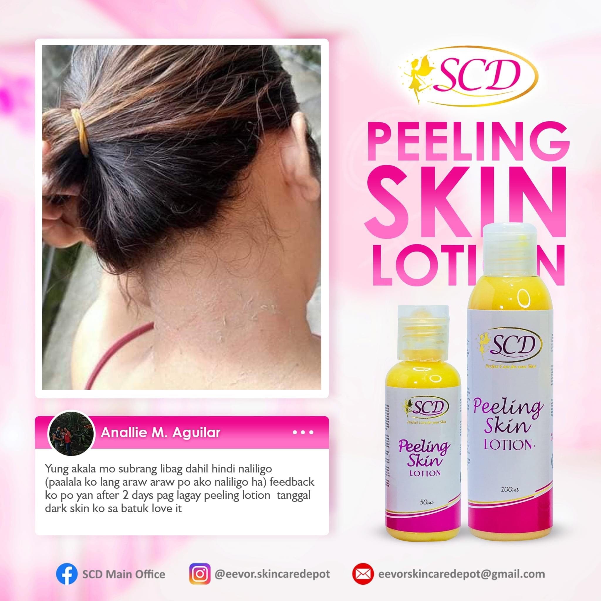 SCD Peeling Skin Lotion 100ml – ROSYSKIN ESSENTIALS LLC